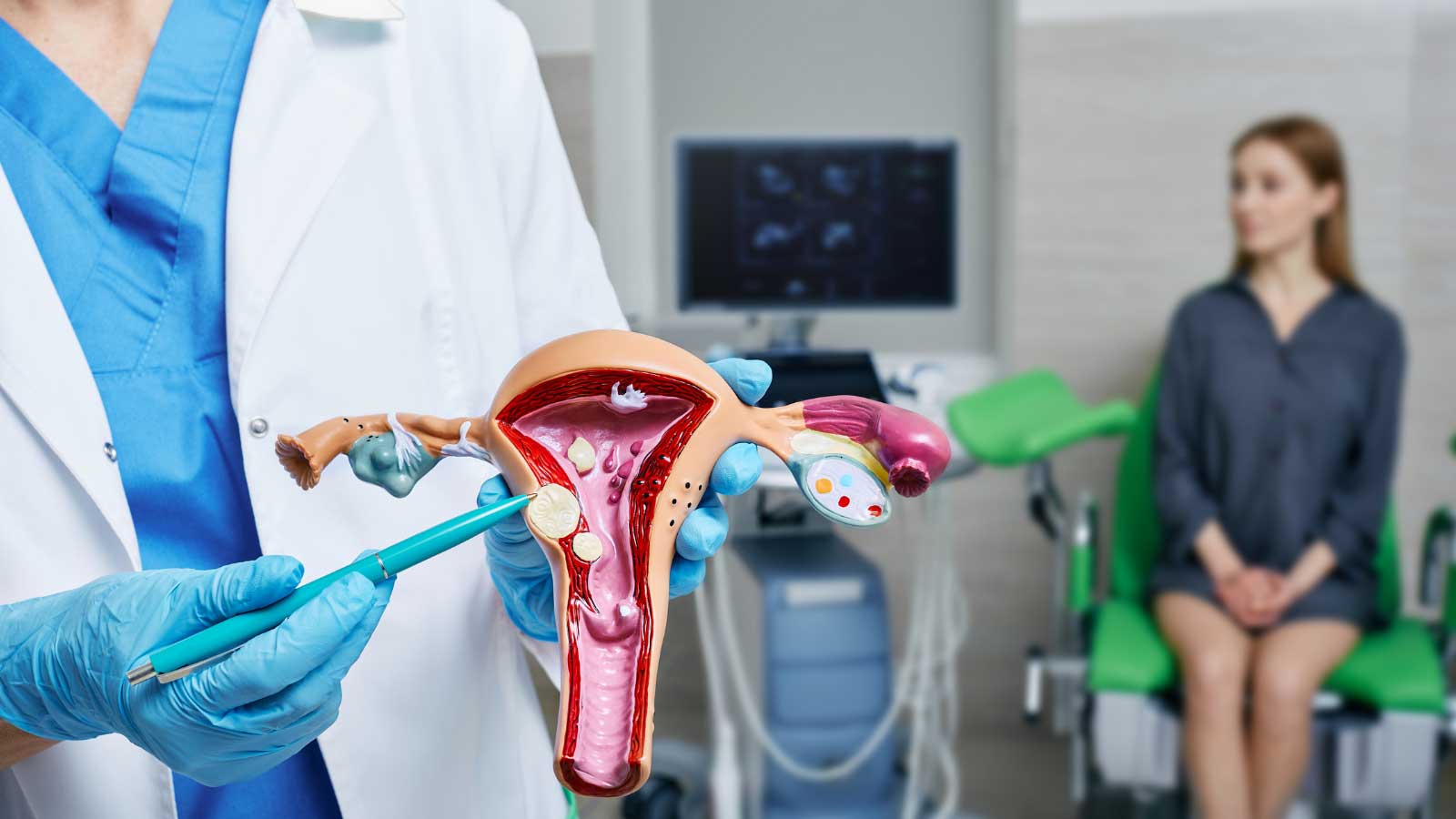 Myomectomy vs Hysterectomy: Advantages of Each in Treating Fibroids
